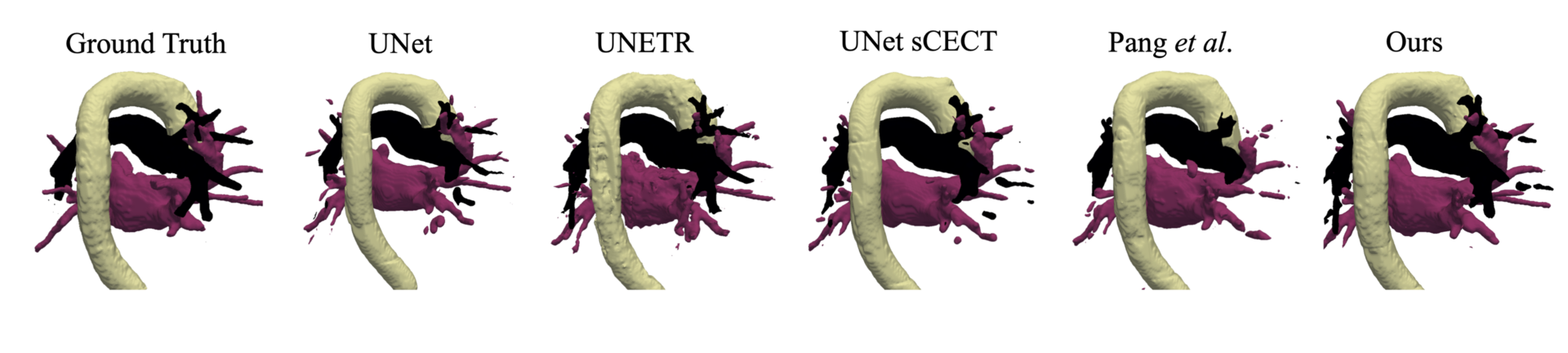 Paper accepted to MICCAI MLMI workshop | Pulmonary Imaging and Computer ...