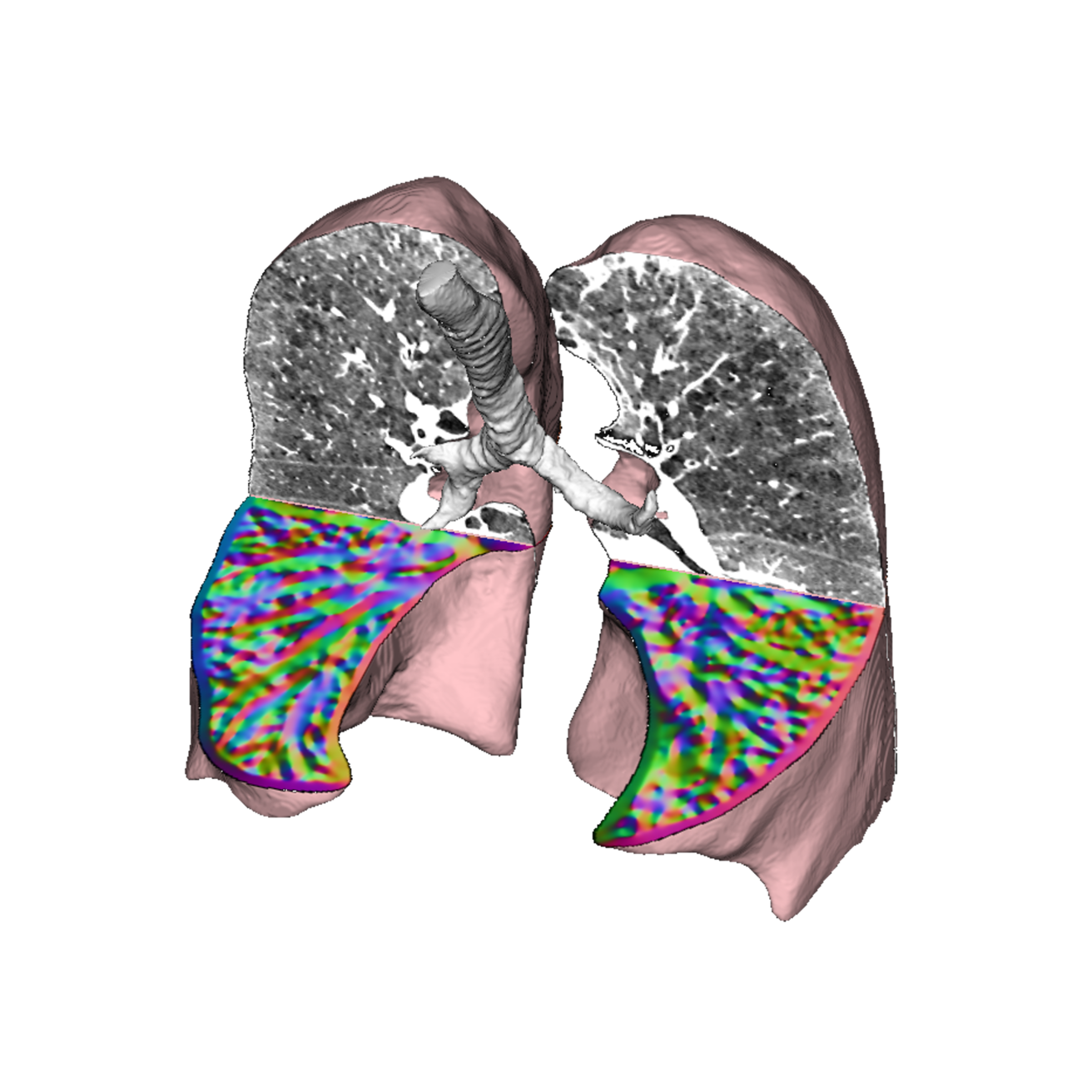 Pulmonary Imaging and Computer Vision Lab | The University of Iowa