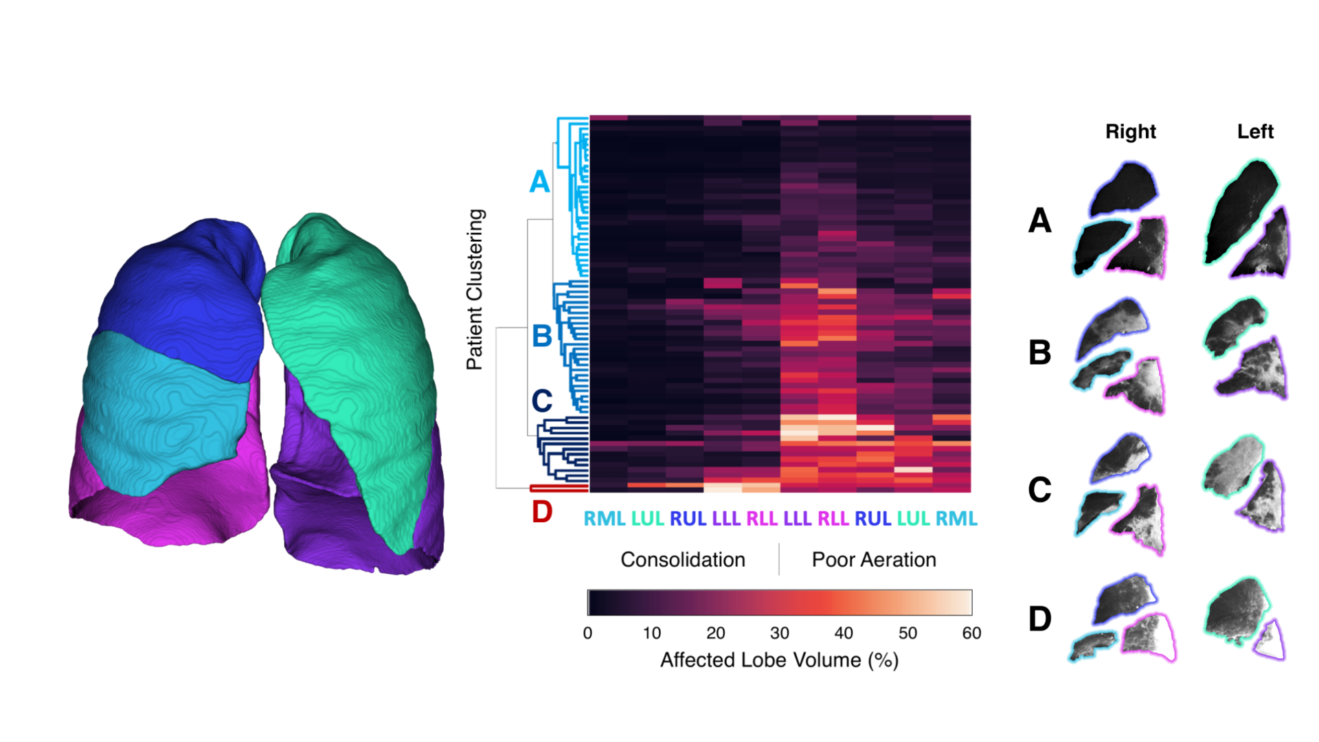 Pulmonary Structure | Pulmonary Imaging and Computer Vision Lab - The ...